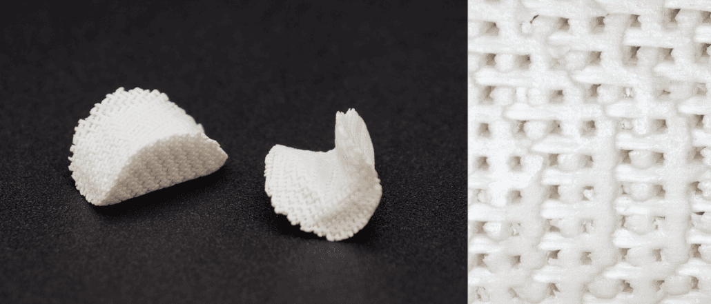 Absorbable Orthopedic & Craniomaxillofacial Implants | Poly-Med